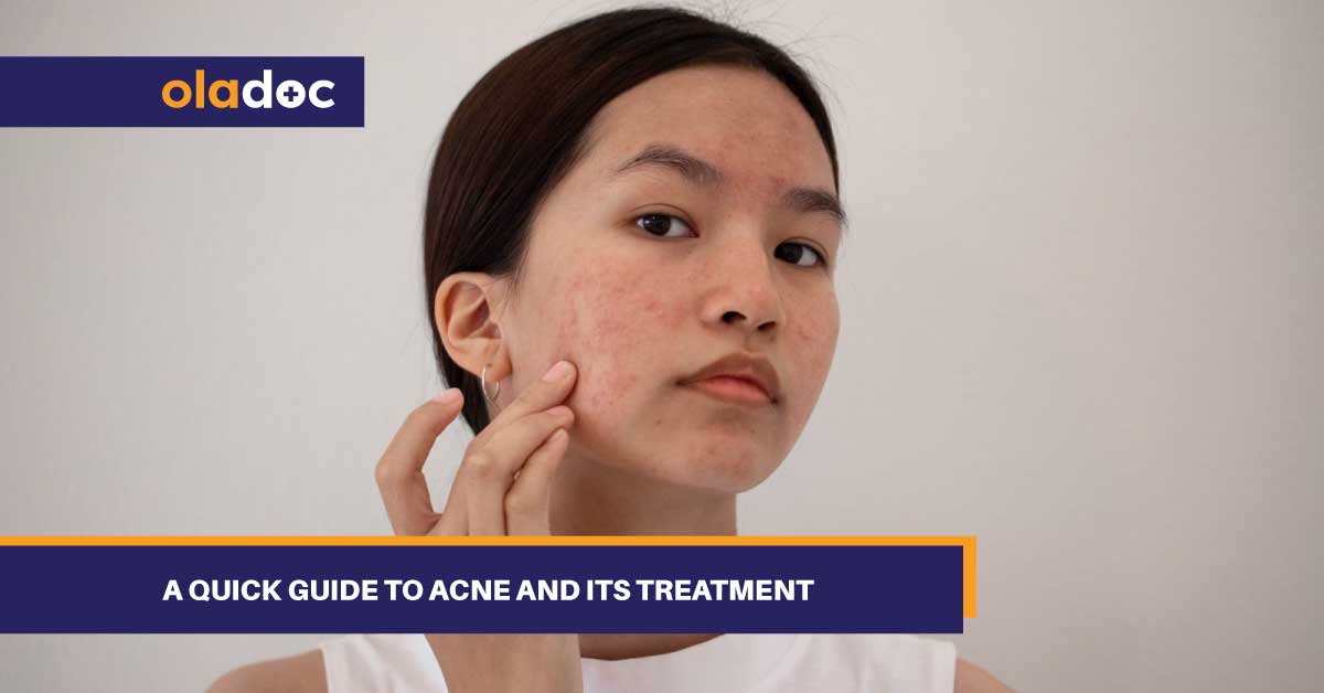 A Quick Guide To Acne And Its Treatment