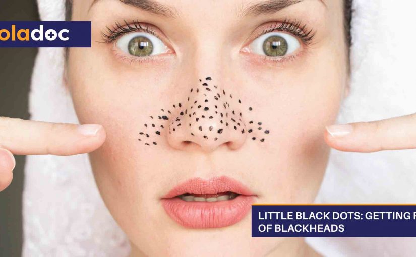 Little Black Dots Getting Rid Of Blackheads Beauty And Skin Care